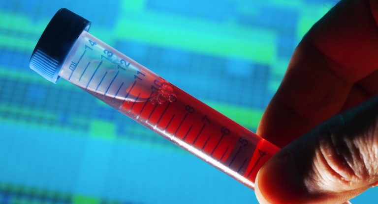 Coming Soon: A Blood Test for Autism