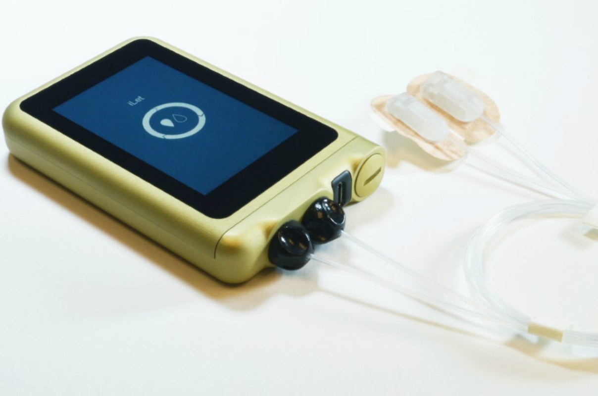 The iLet Bionic Pancreas Could Change Diabetes Treatment